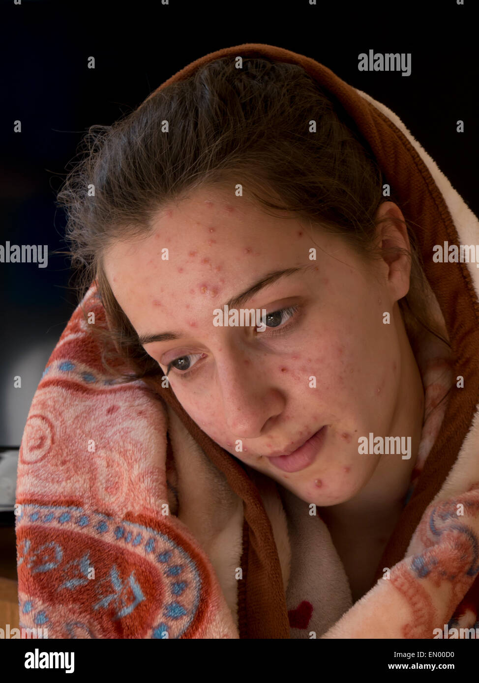 Ugly Teen High Resolution Stock Photography and Images - Alamy