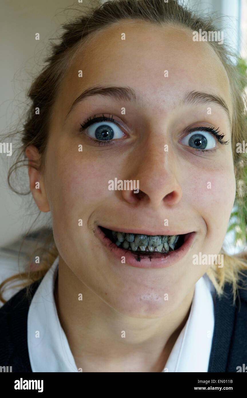 girl shock teeth Stock Photo - Alamy