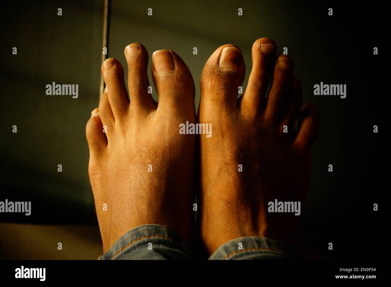 Unique Feet of mine Stock Photo - Alamy