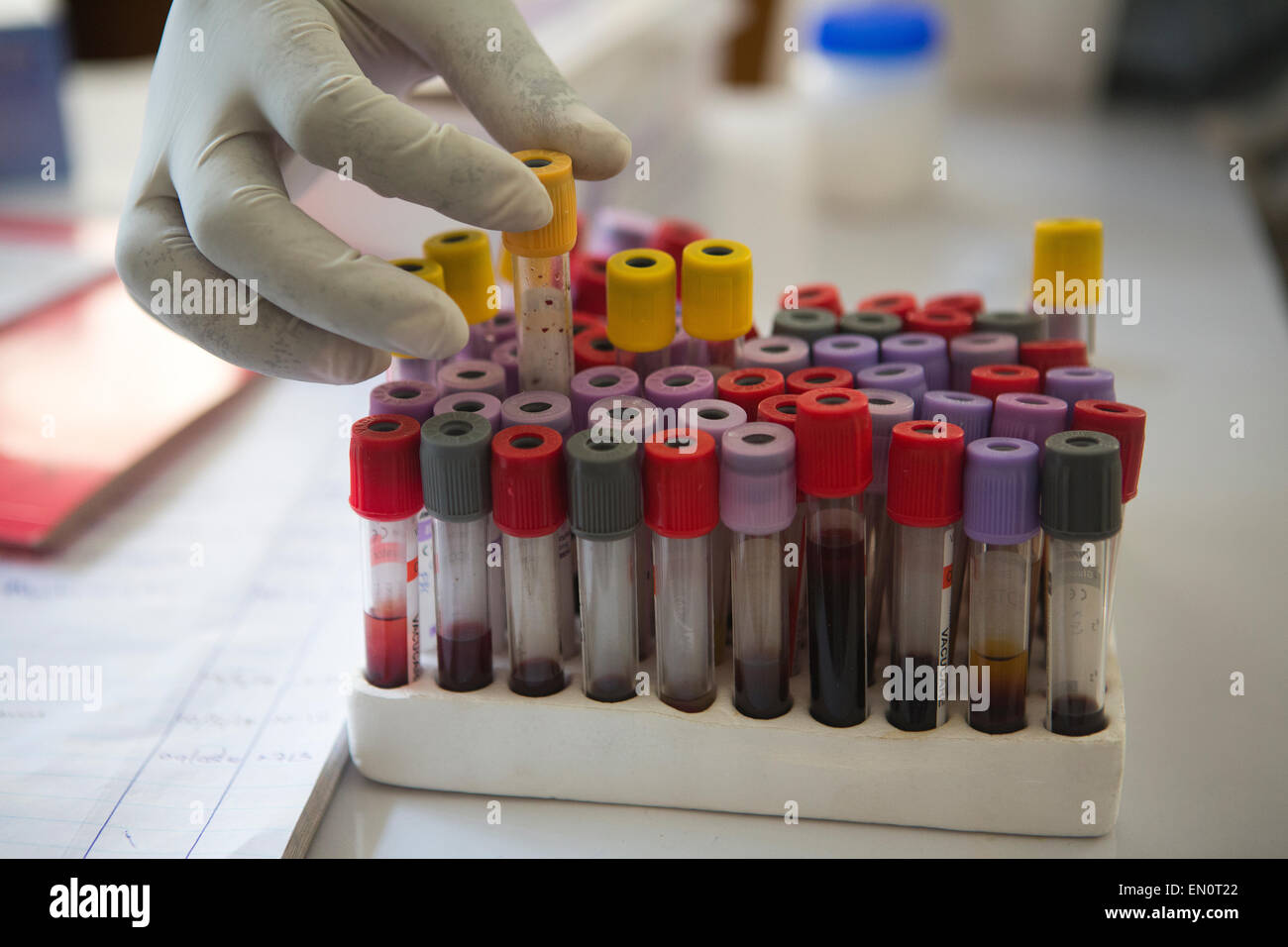Hiv Aids In Africa High Resolution Stock Photography and Images - Alamy