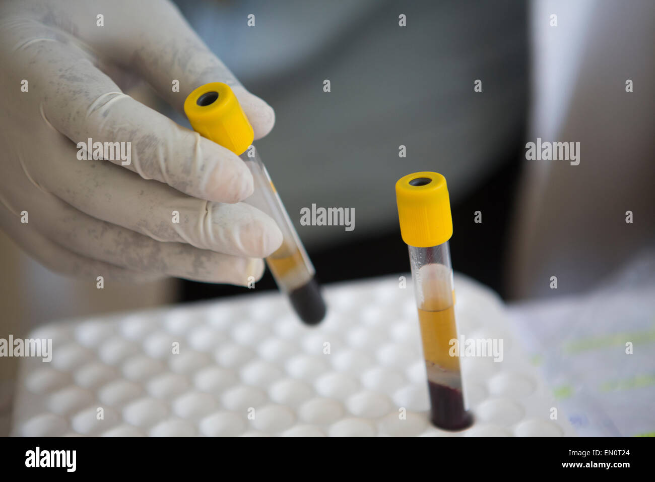 Hiv aids in africa hi-res stock photography and images - Alamy