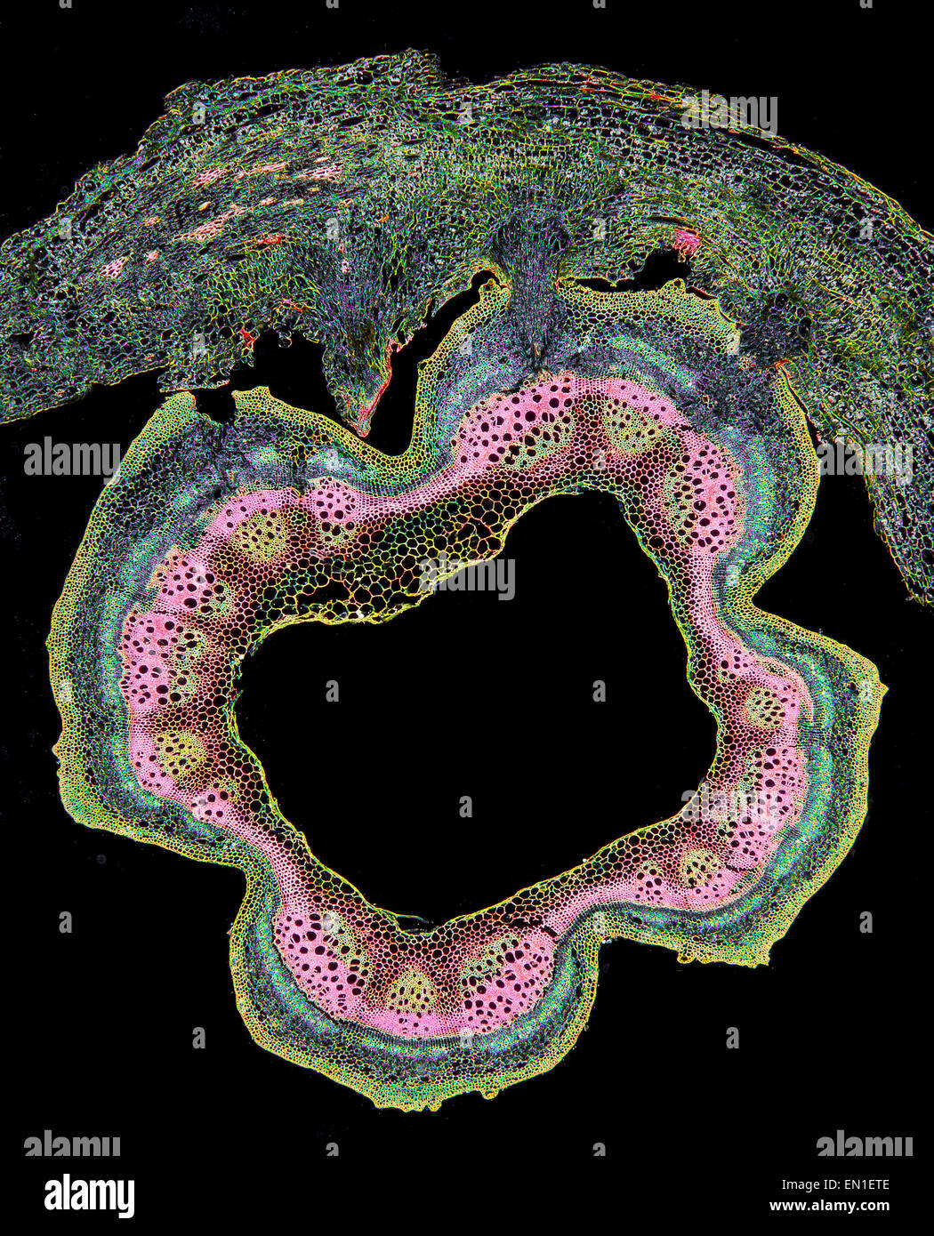 Micrograph microscope slide stained osmosis on stinging nettle ts ...