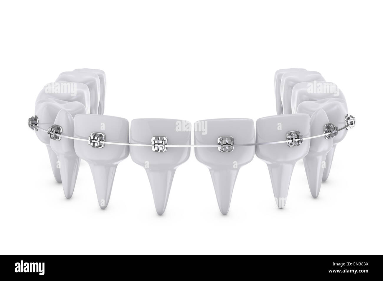 Metal braces teeth Cut Out Stock Images & Pictures - Alamy