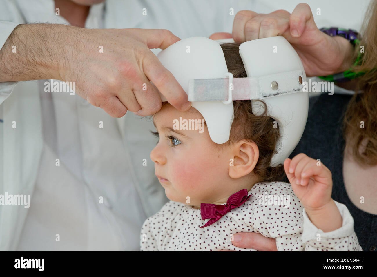 Deformed baby hi-res stock photography and images - Alamy