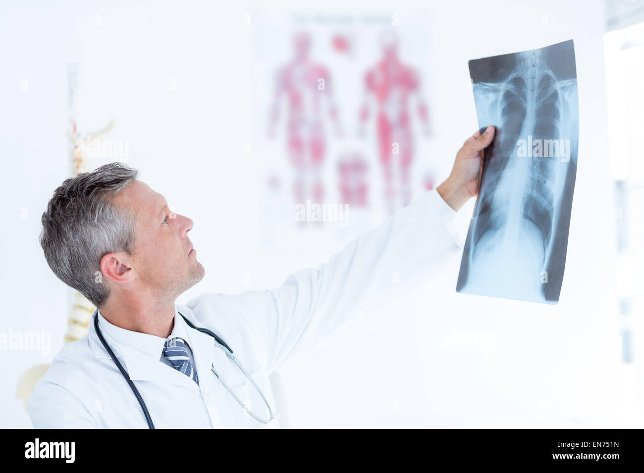 Thoughtful doctor holding xray Stock Photo - Alamy