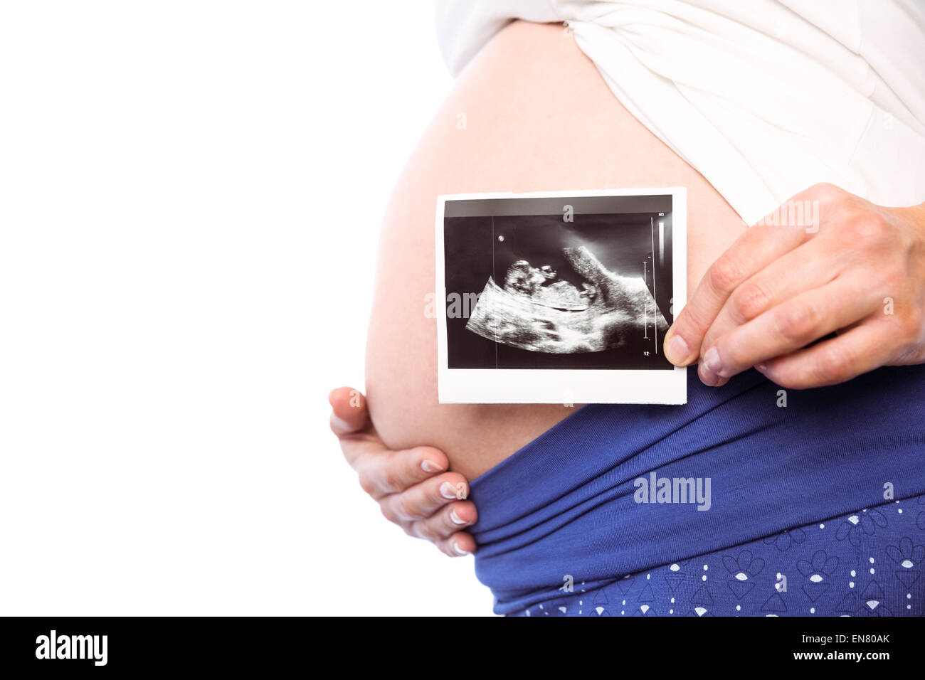 Pregnant woman showing ultrasound scans Stock Photo - Alamy