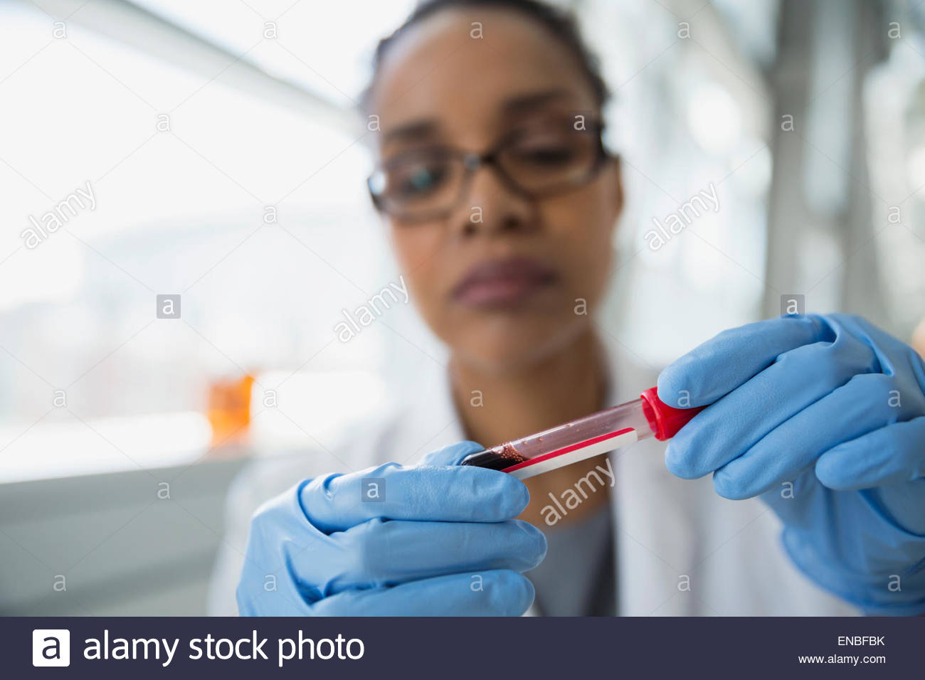Woman blood sample scientist hi-res stock photography and images - Alamy