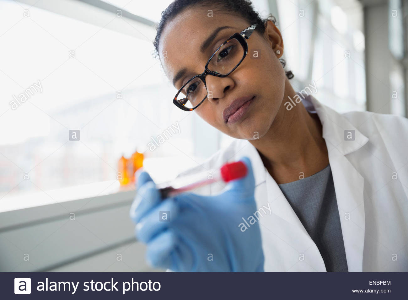 Scientist examining blood sample in hi-res stock photography and images ...