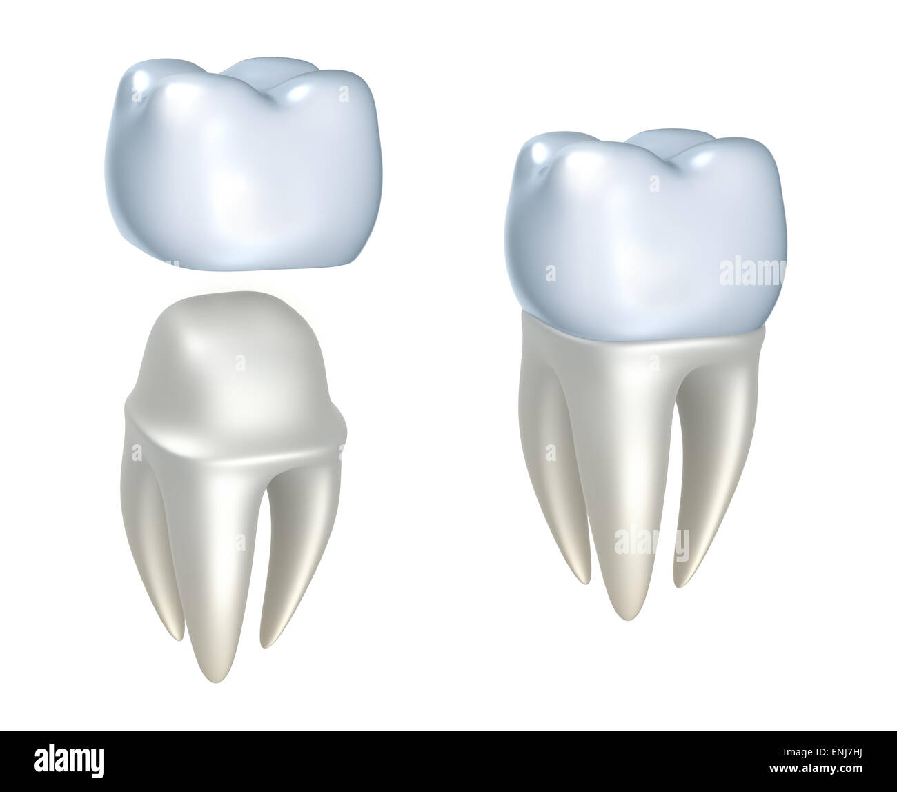 Dental crowns and tooth, isolated on white Stock Photo - Alamy