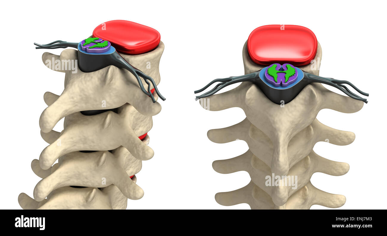 Spinal marrow nerves hi-res stock photography and images - Alamy