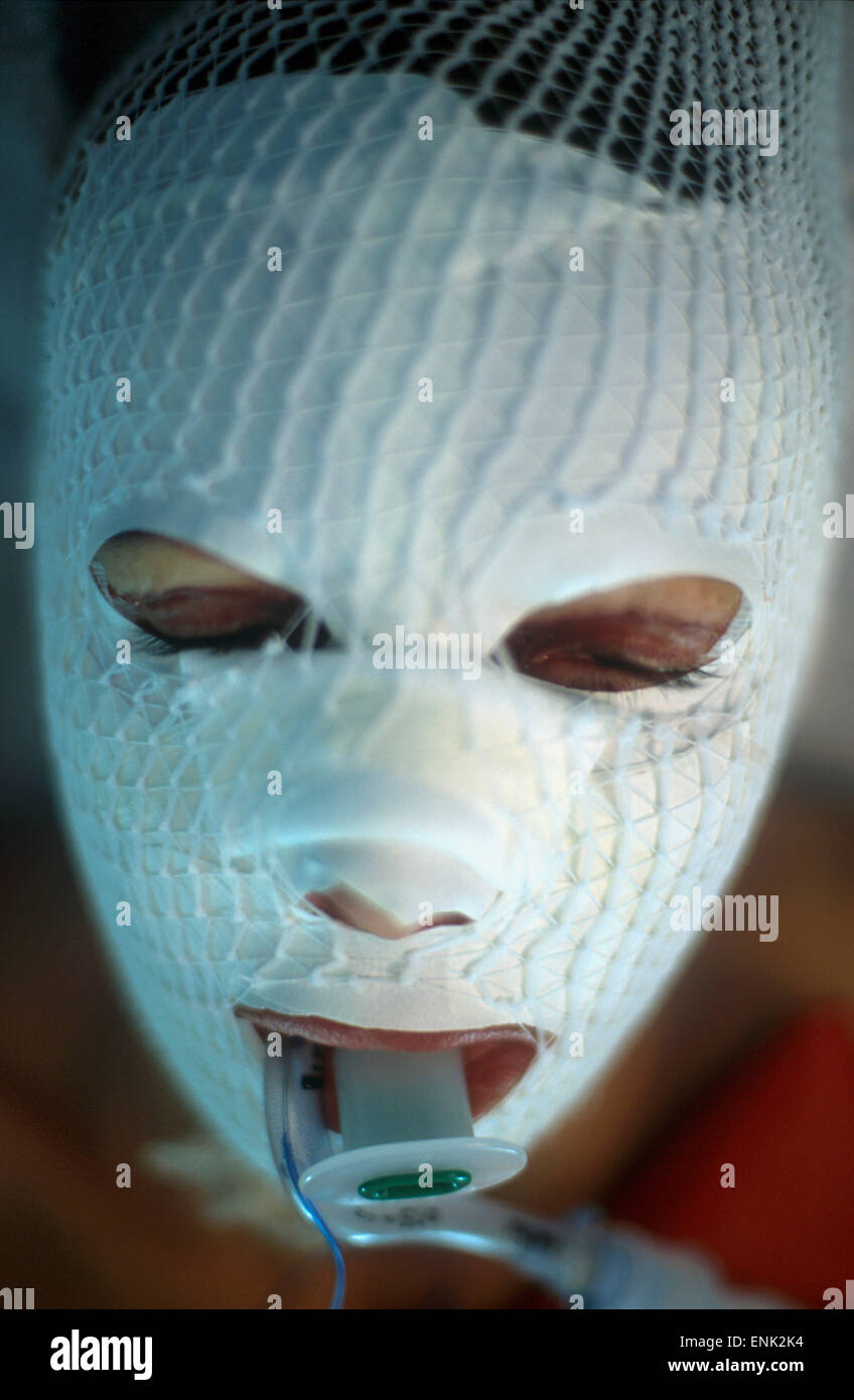 Facial plastic surgery Stock Photo - Alamy