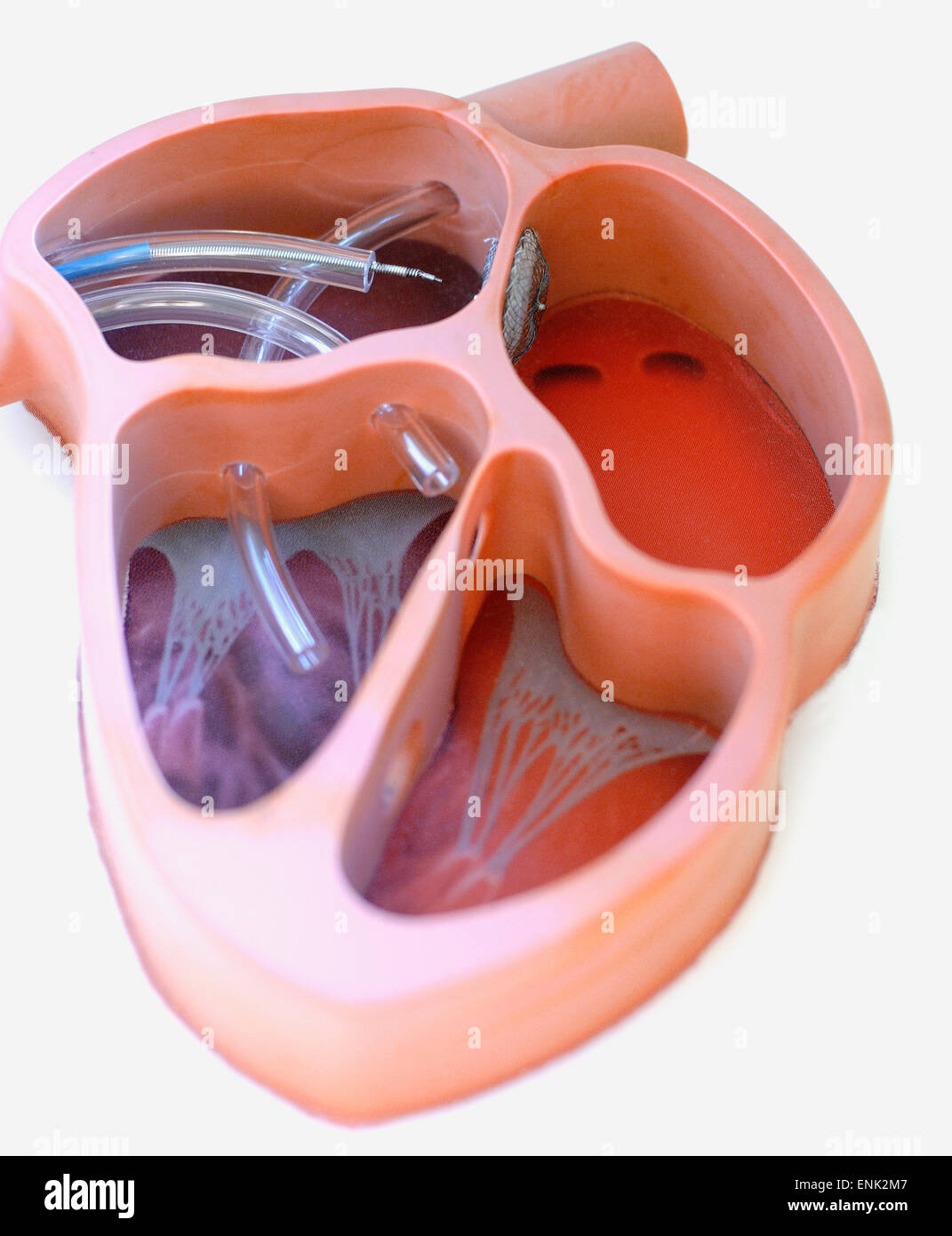Cardiovascular malformation hi-res stock photography and images - Alamy