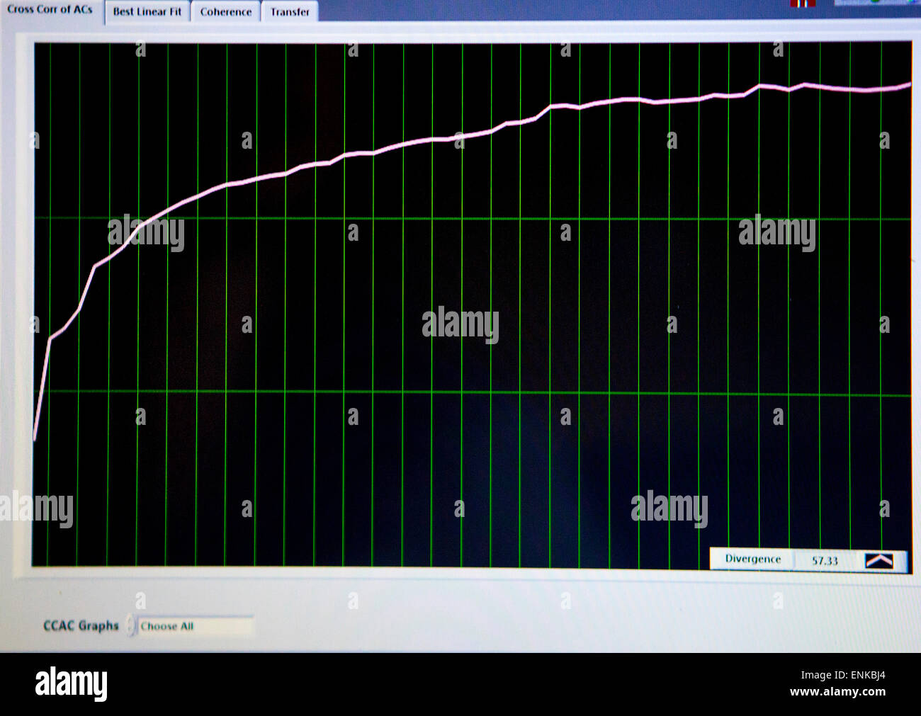 Neurofeedback hi-res stock photography and images - Alamy