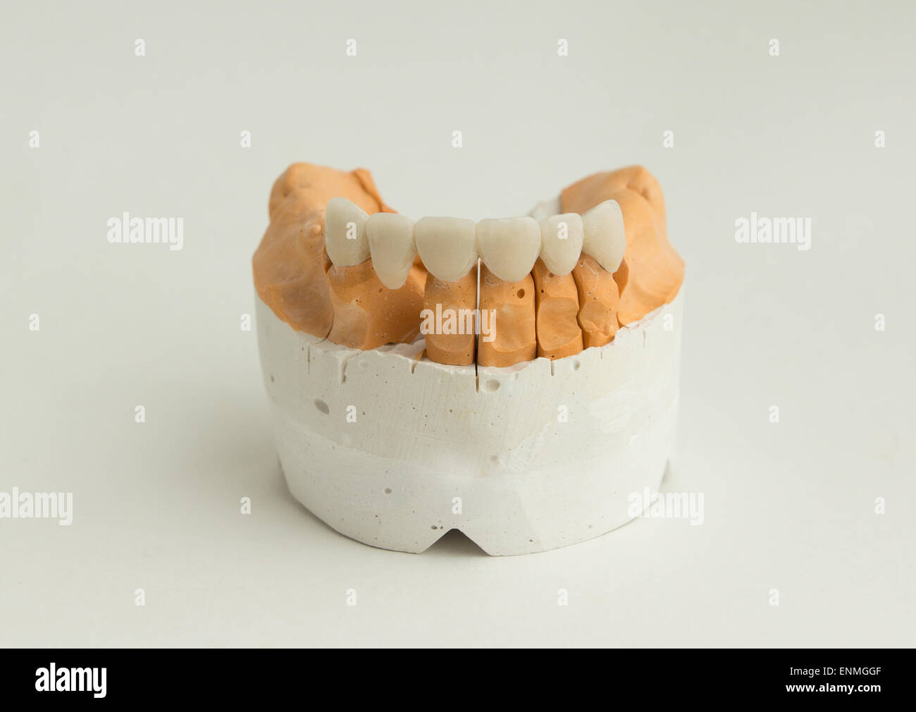 Artificial teeth made ceramics hi-res stock photography and images - Alamy