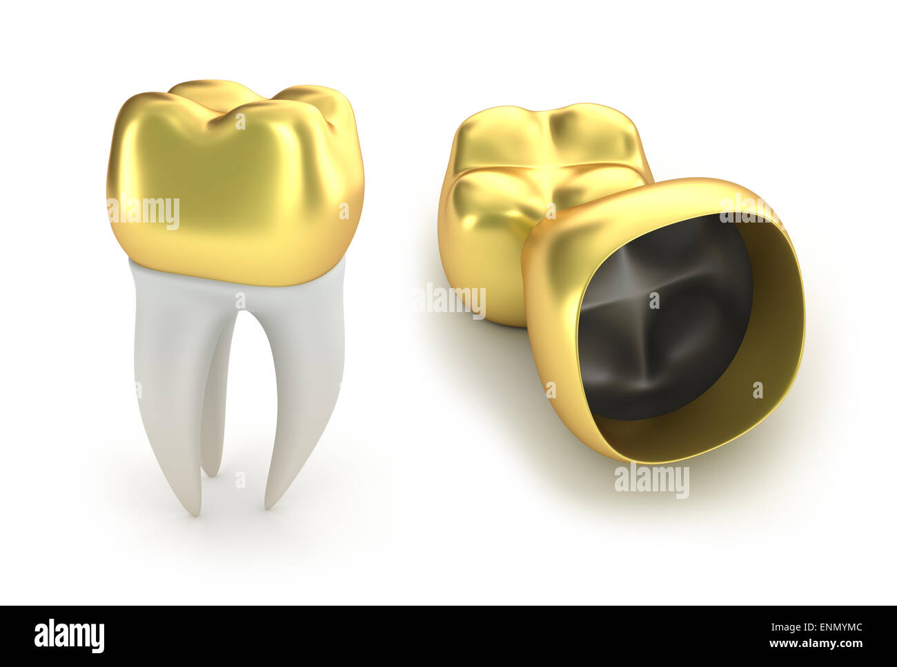Golden Dental crowns and tooth, isolated on white Stock Photo - Alamy