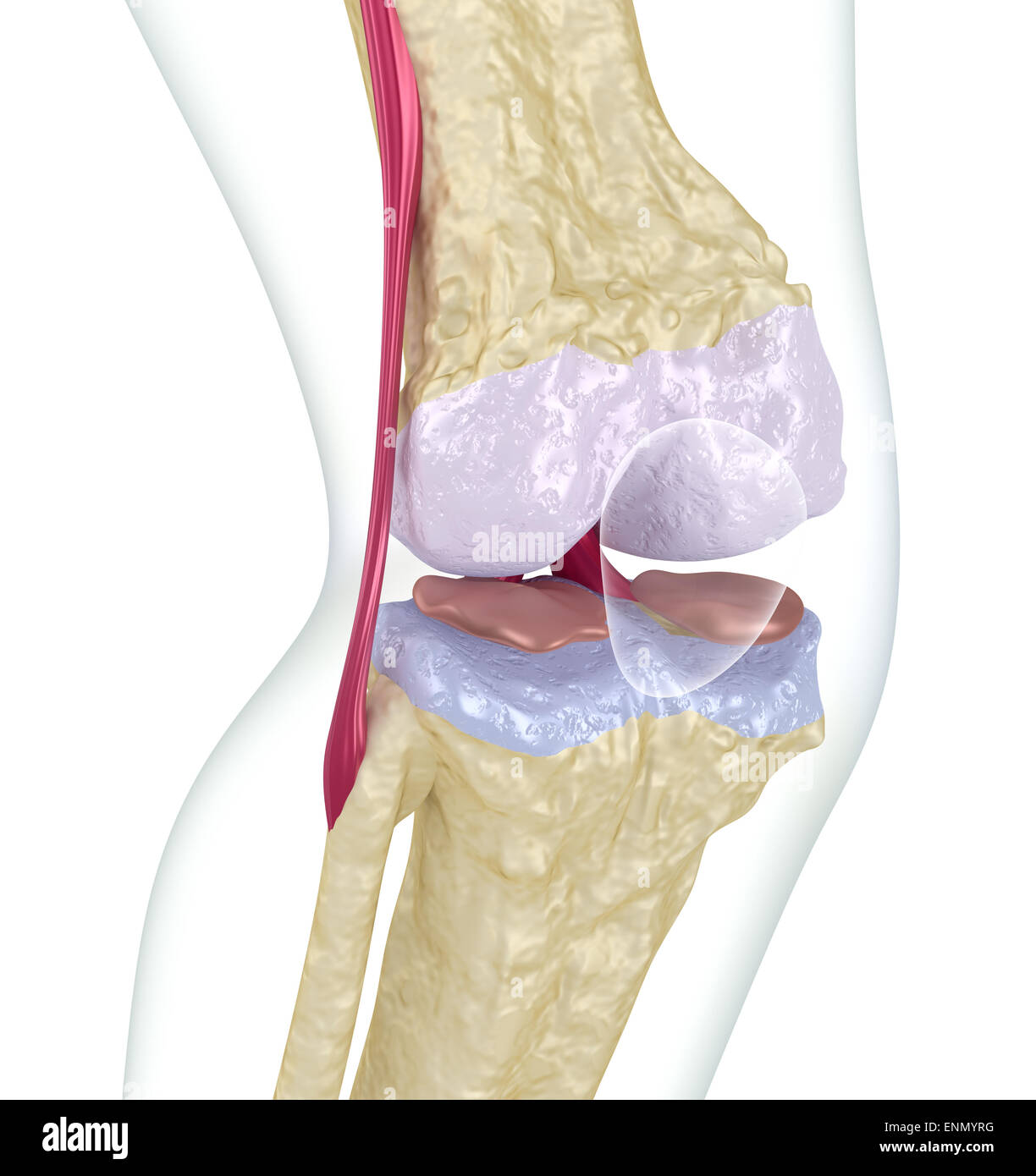 Osteoporosis of the knee joint Stock Photo - Alamy