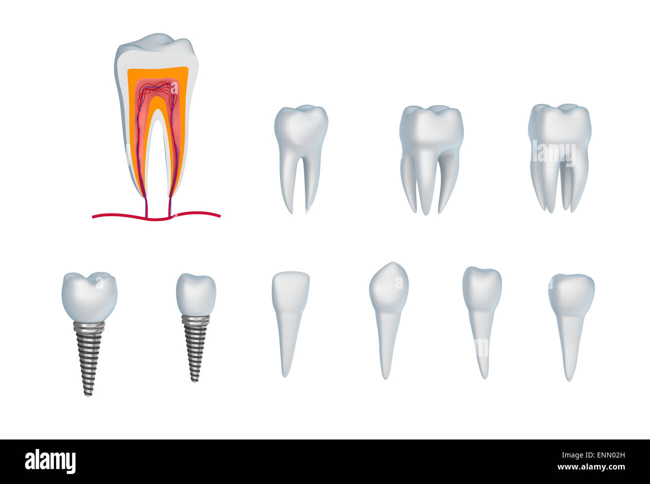 Set of teeth and implants. Isolated on white Stock Photo - Alamy