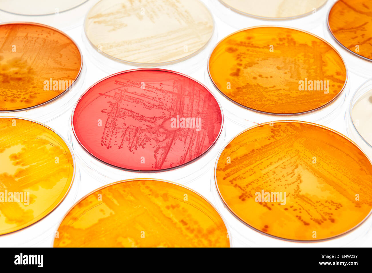 MacConkey agar a selective clinical microbiology lab culture medium to ...