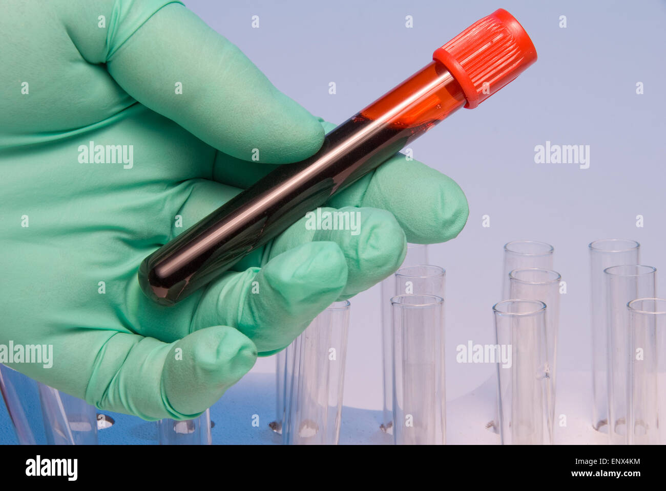Blood sa hi-res stock photography and images - Alamy