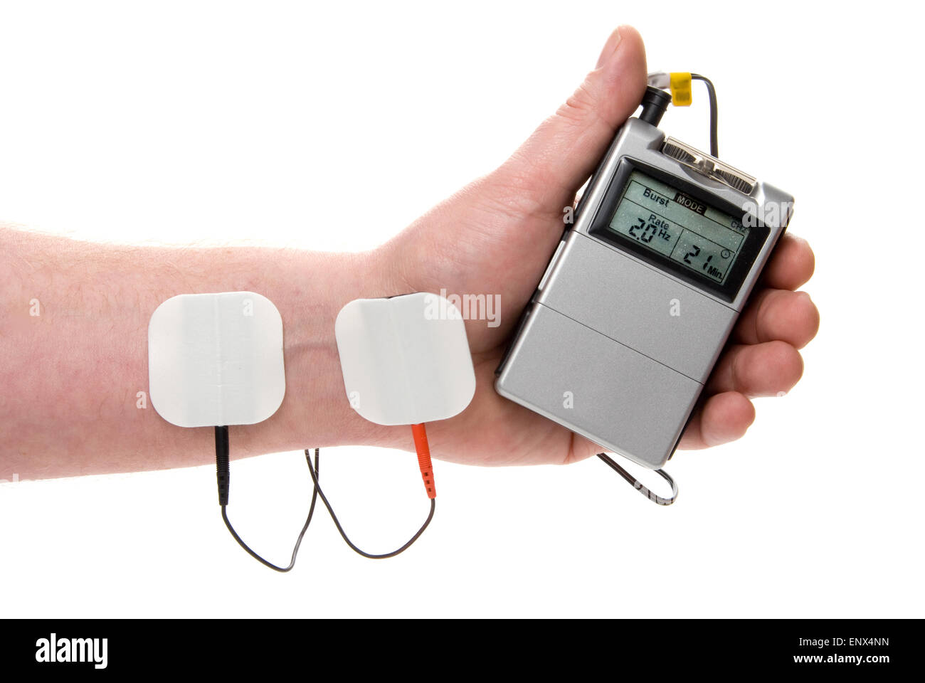 Tens transcutaneous electrical nerve hi-res stock photography and ...