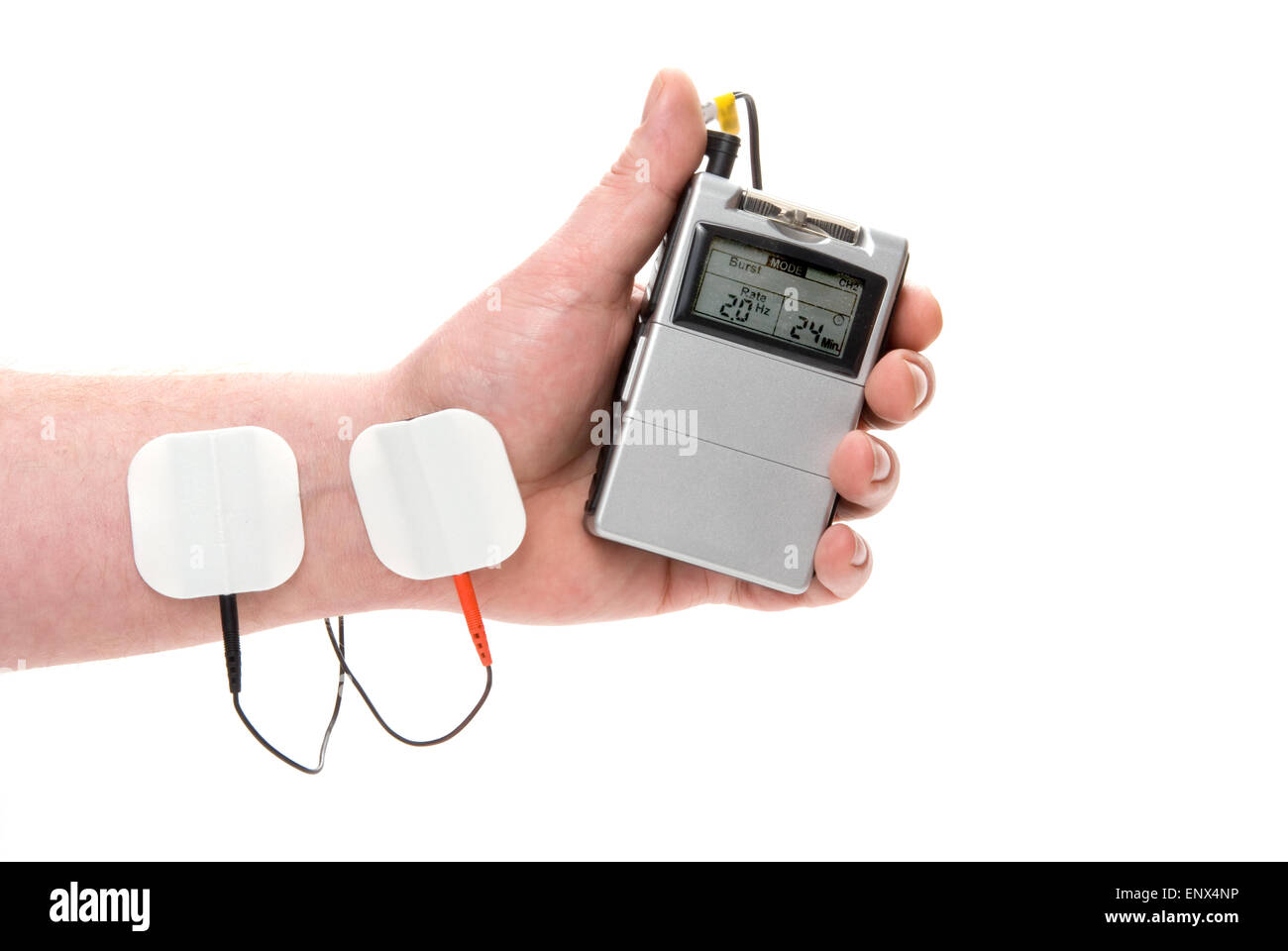Tens transcutaneous electrical nerve hi-res stock photography and ...