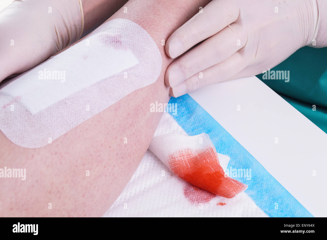 Doctor patches a Wound on the Leg Stock Photo - Alamy