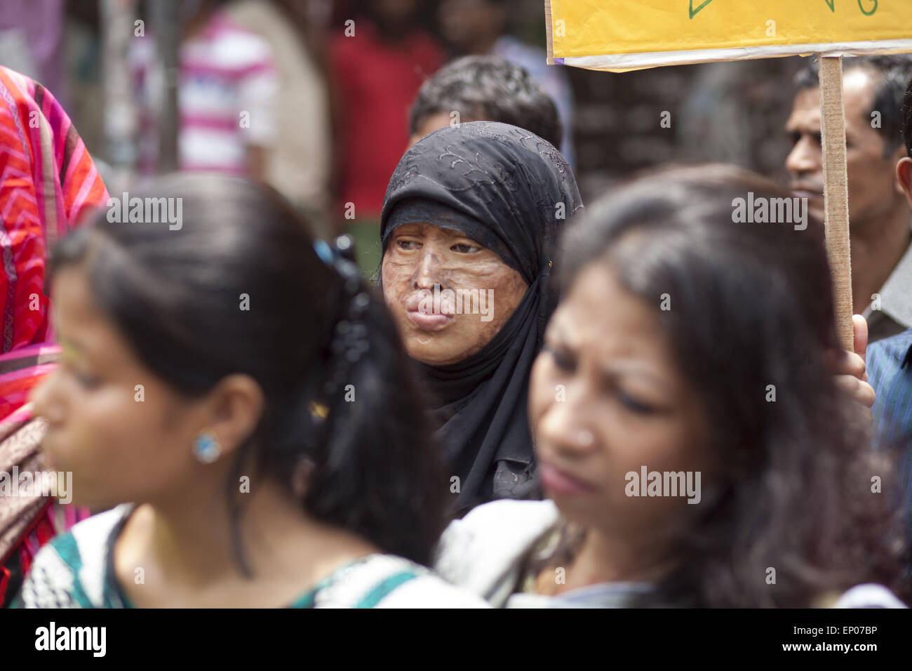 Dhaka, Bangladesh. 12th May, 2015. Survivors of acid attacks, attend a ...