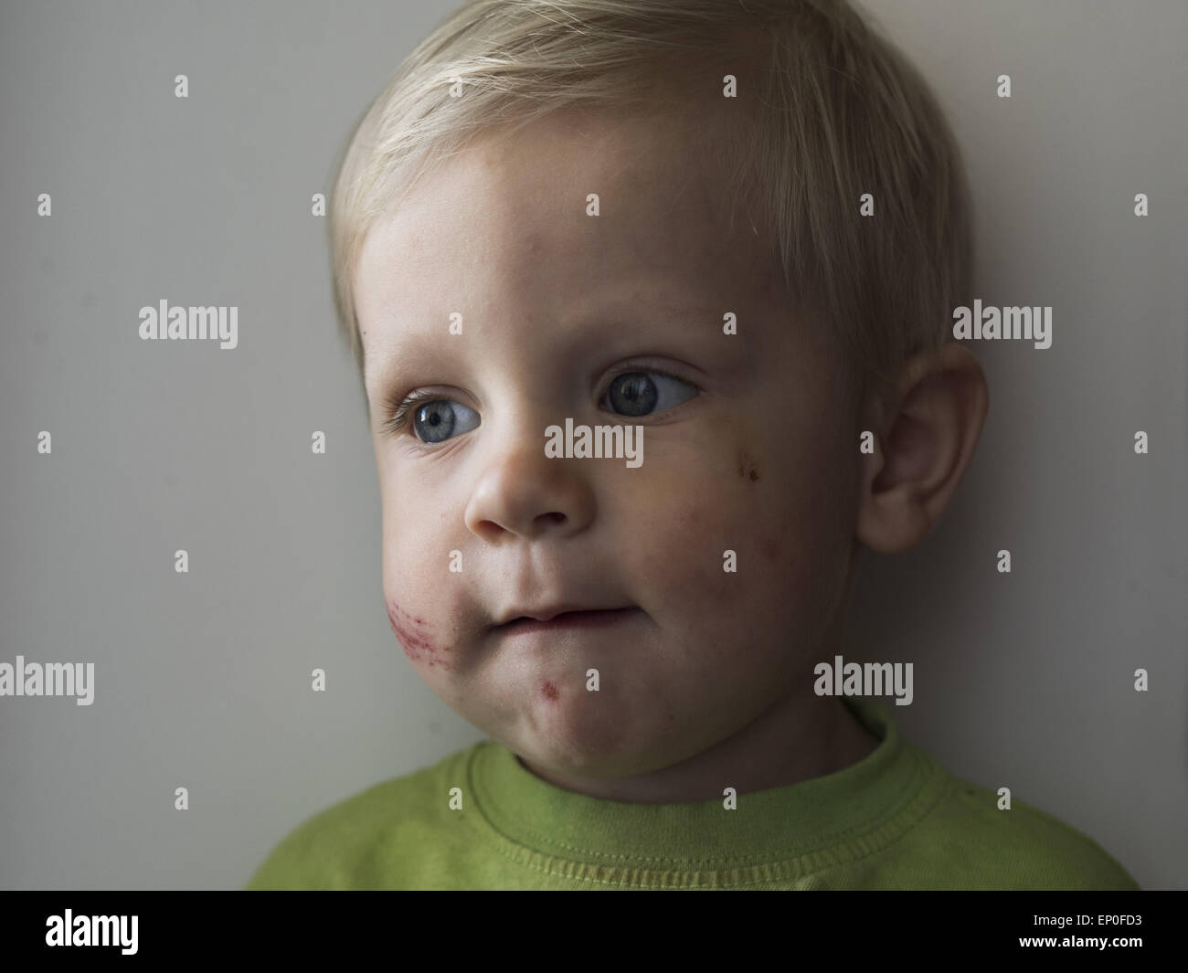 May 12, 2015 - Portrait of a little boy with a scratched face © Igor ...