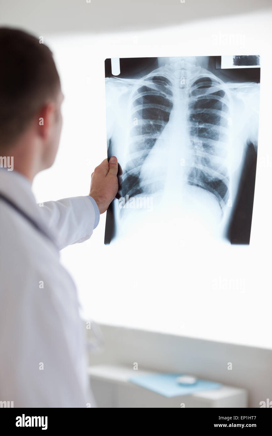 Close up of doctor holding x-ray against light Stock Photo - Alamy
