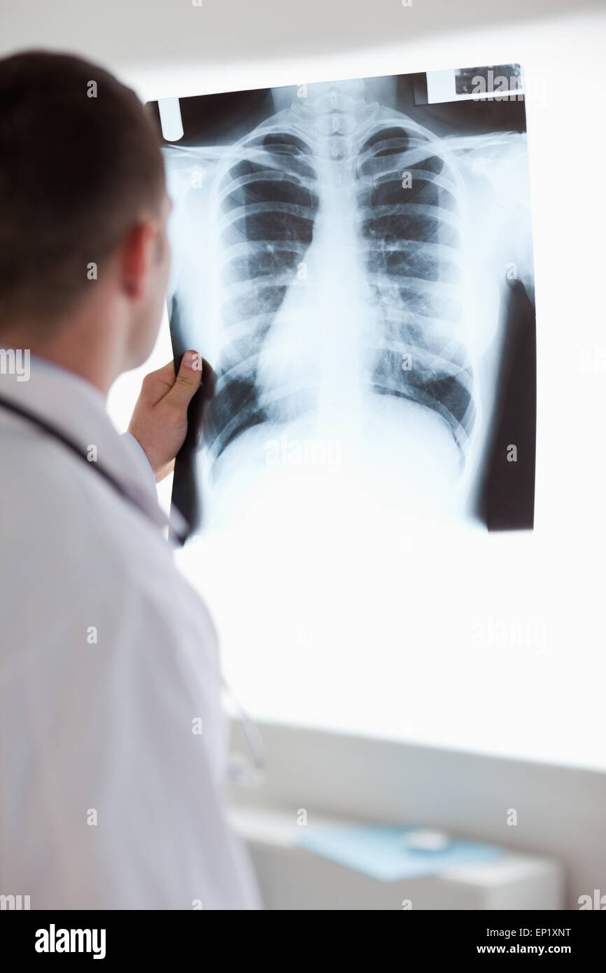 Close up of doctor using light to check x-ray Stock Photo - Alamy