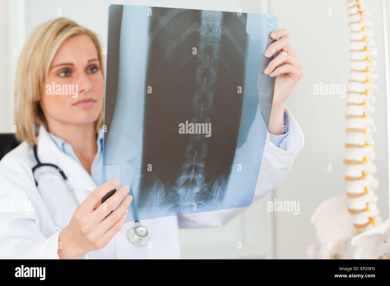 Sad looking doctor looking at x-ray Stock Photo - Alamy
