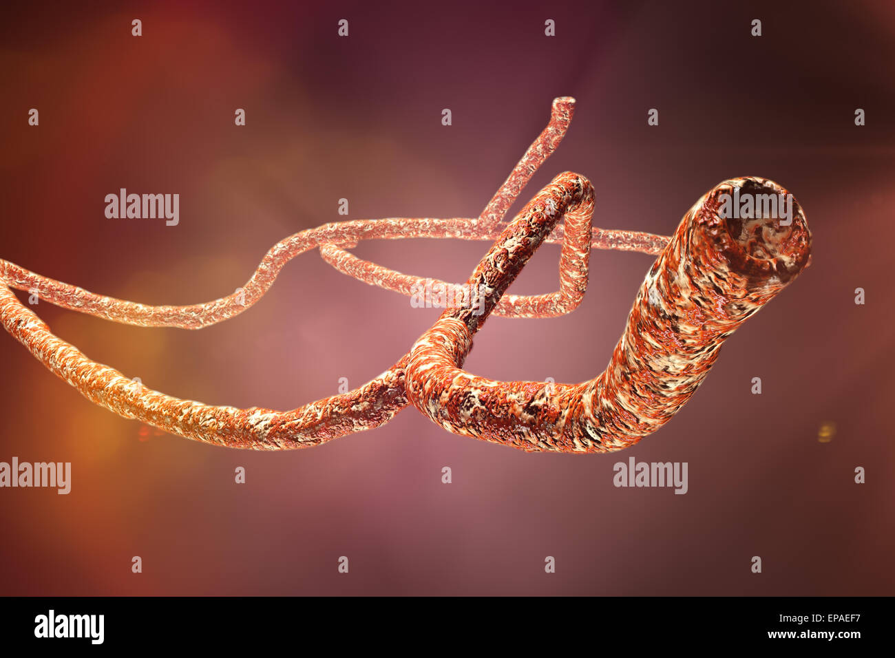 Ebola Virus Disease Evd High Resolution Stock Photography and Images ...