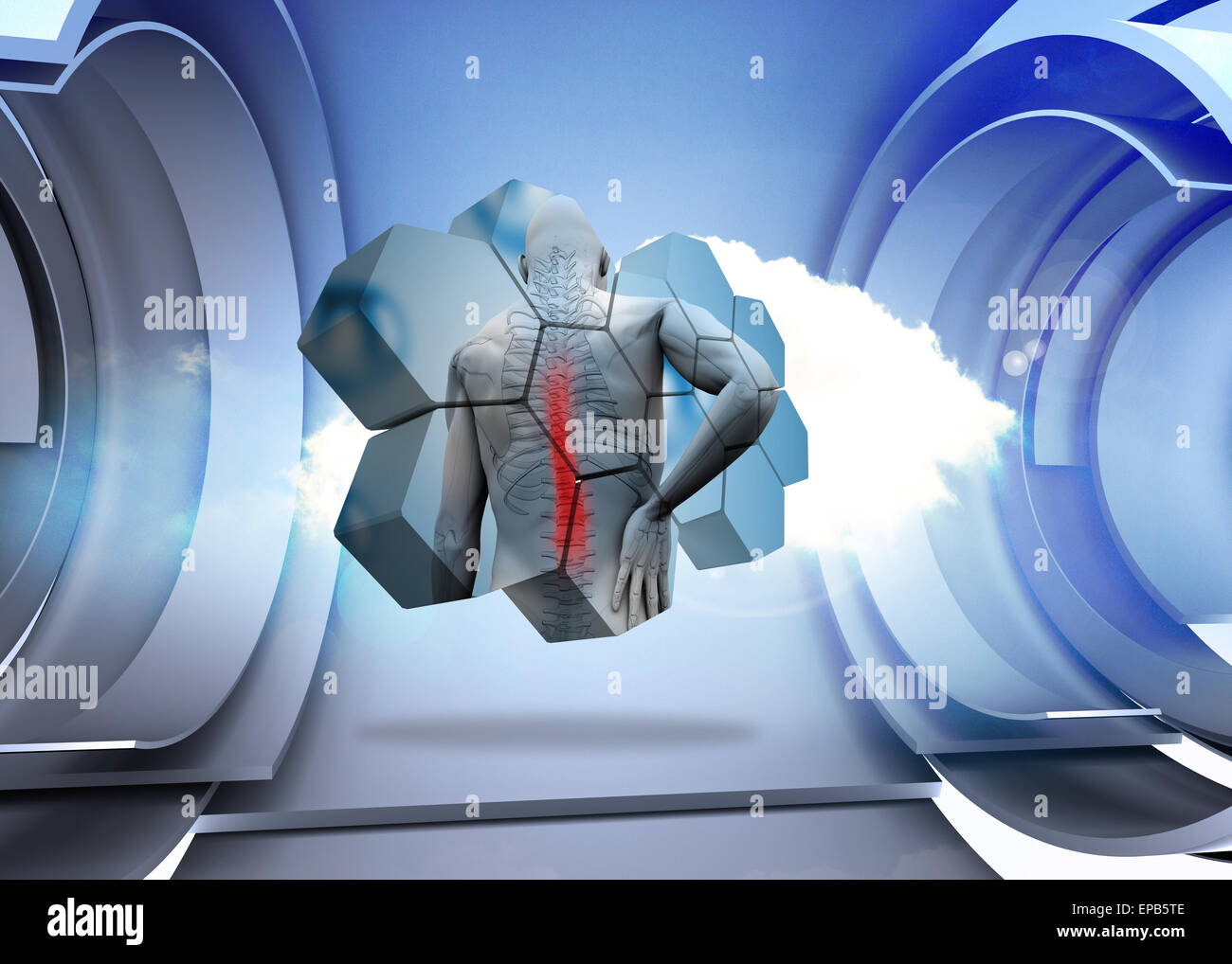 Composite image of back injury diagram on abstract screen Stock Photo ...