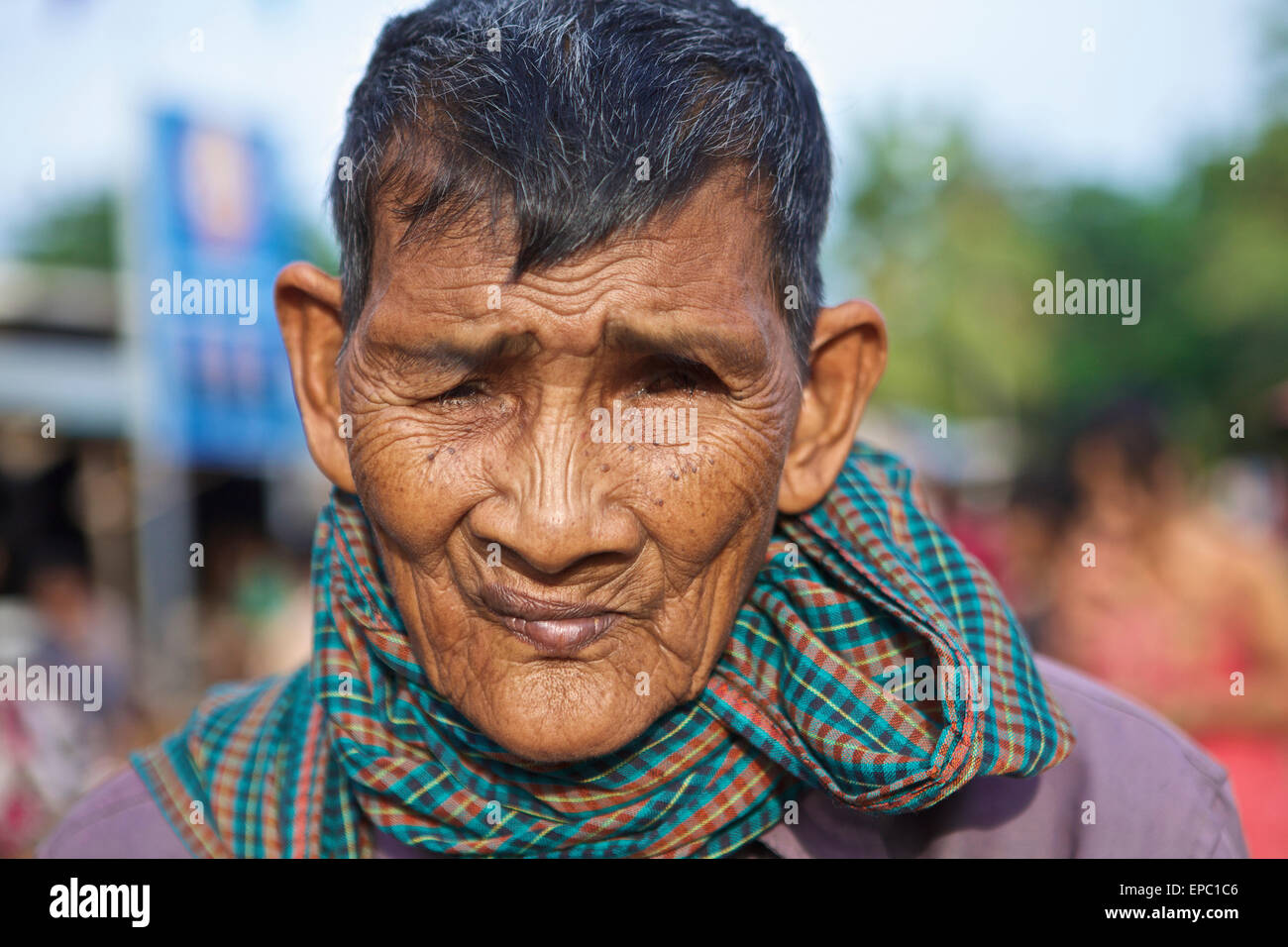 Elderly man with one eye; Battambang, Cambodia Stock Photo - Alamy