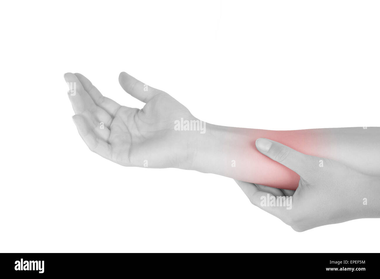 Muscle Strain Arm