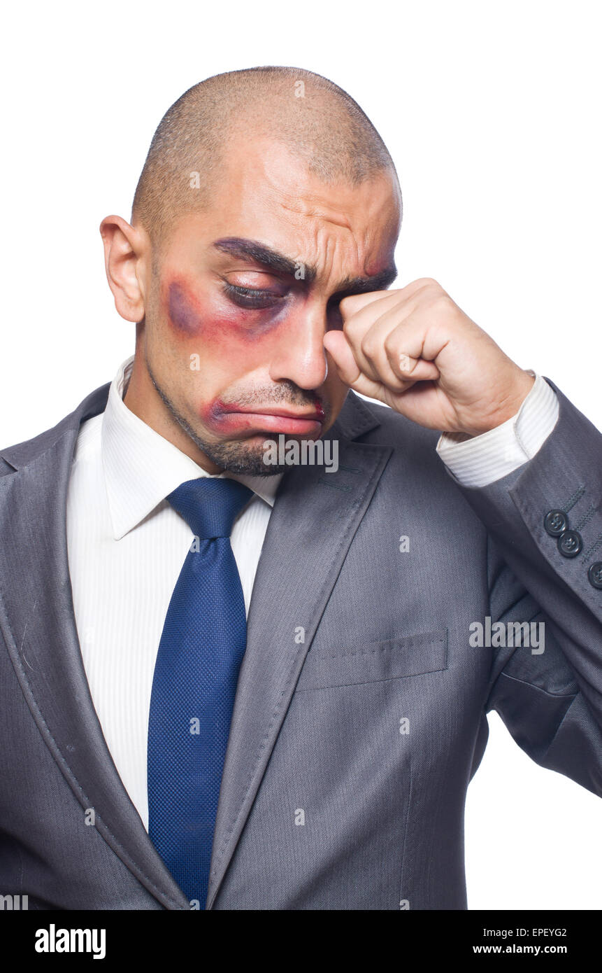 Badly beaten businessman isolated on white Stock Photo - Alamy