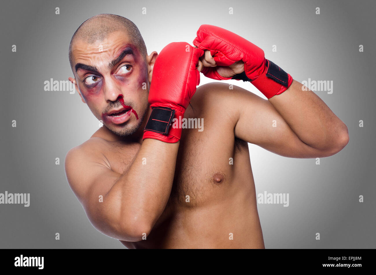 Badly beaten boxer isolated on white Stock Photo - Alamy