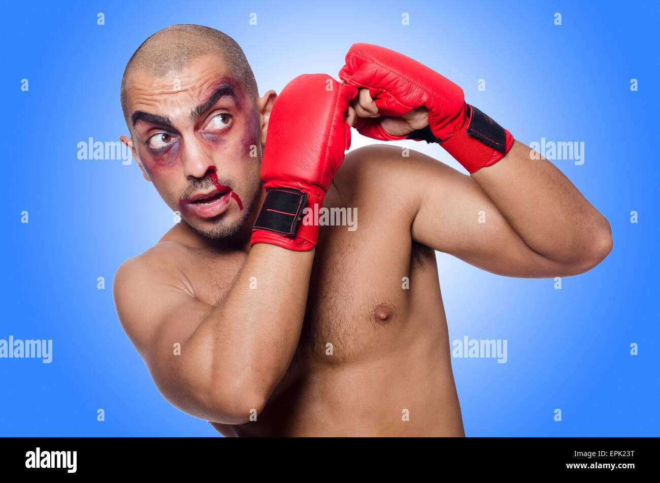 Badly beaten boxer isolated on white Stock Photo - Alamy