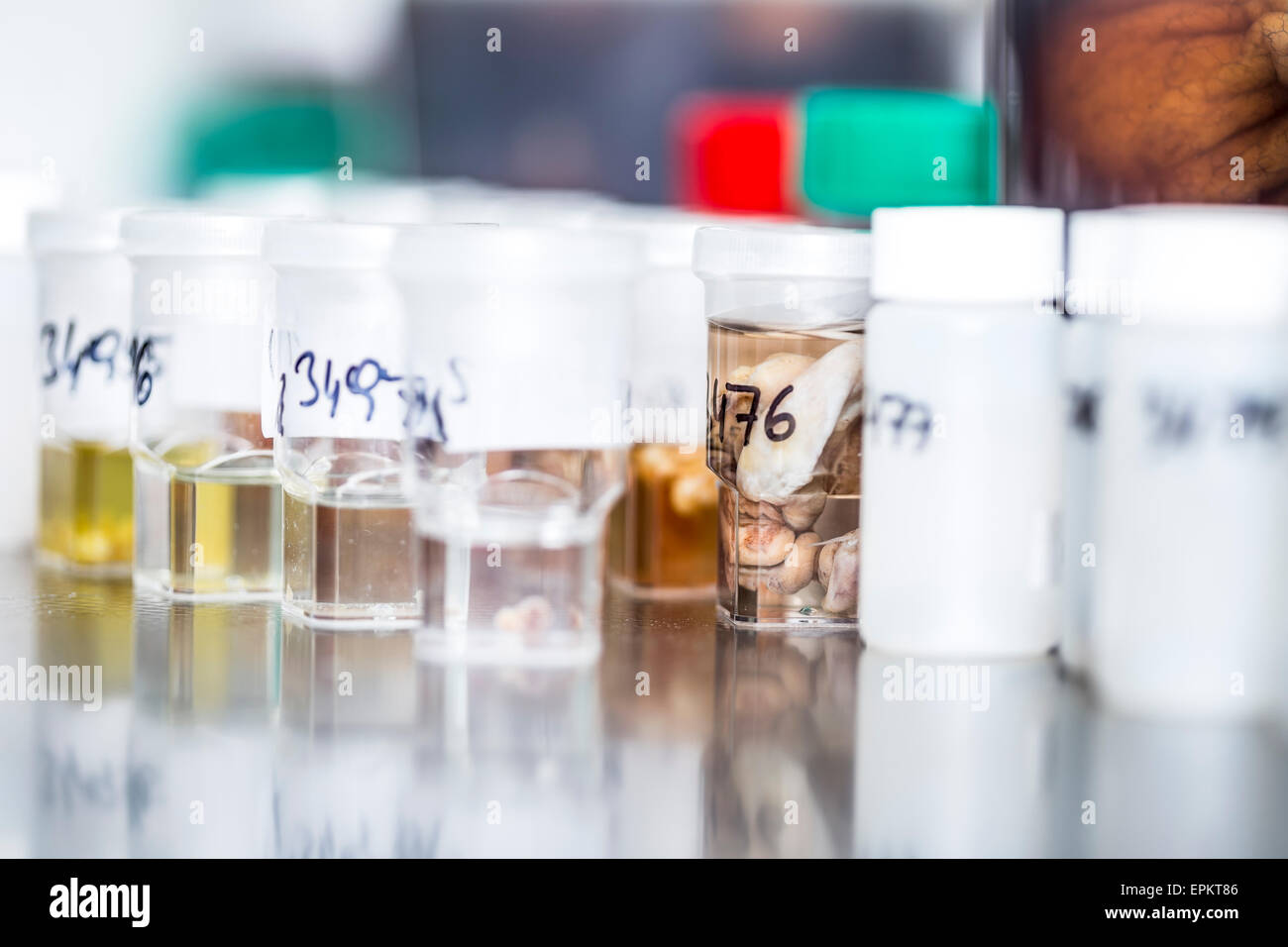 Tissue samples in clinical laboratory Stock Photo - Alamy
