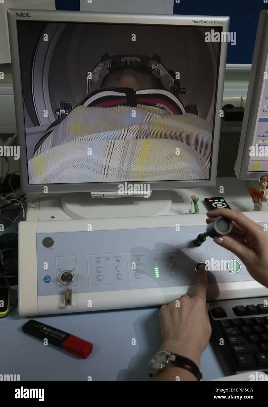 Gamma Knife Radiosurgery High Resolution Stock Photography and Images ...