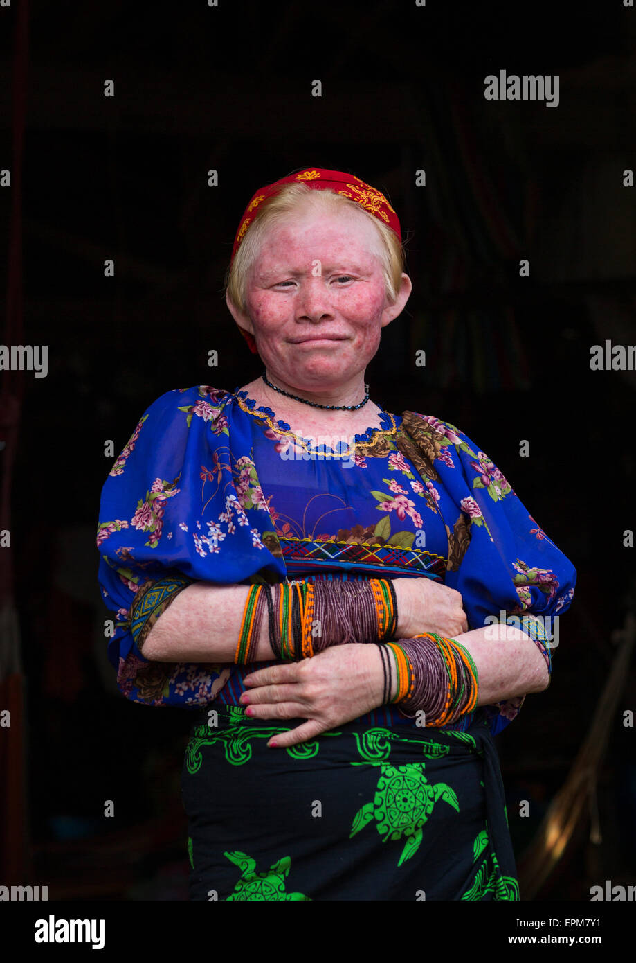 Panama, San Blas Islands, Mamitupu, Portrait Of An Albino Kuna Tribe ...
