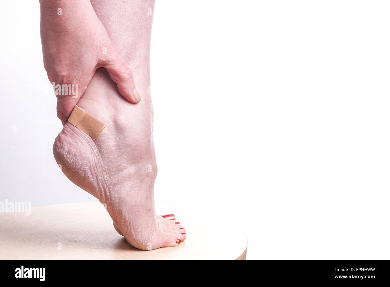 Women with wounds on her ankle . The injury came after she had new ...