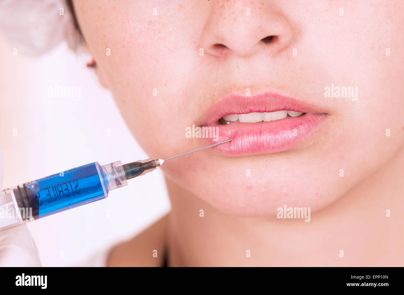 Close up shot of lips getting botox injection Stock Photo - Alamy