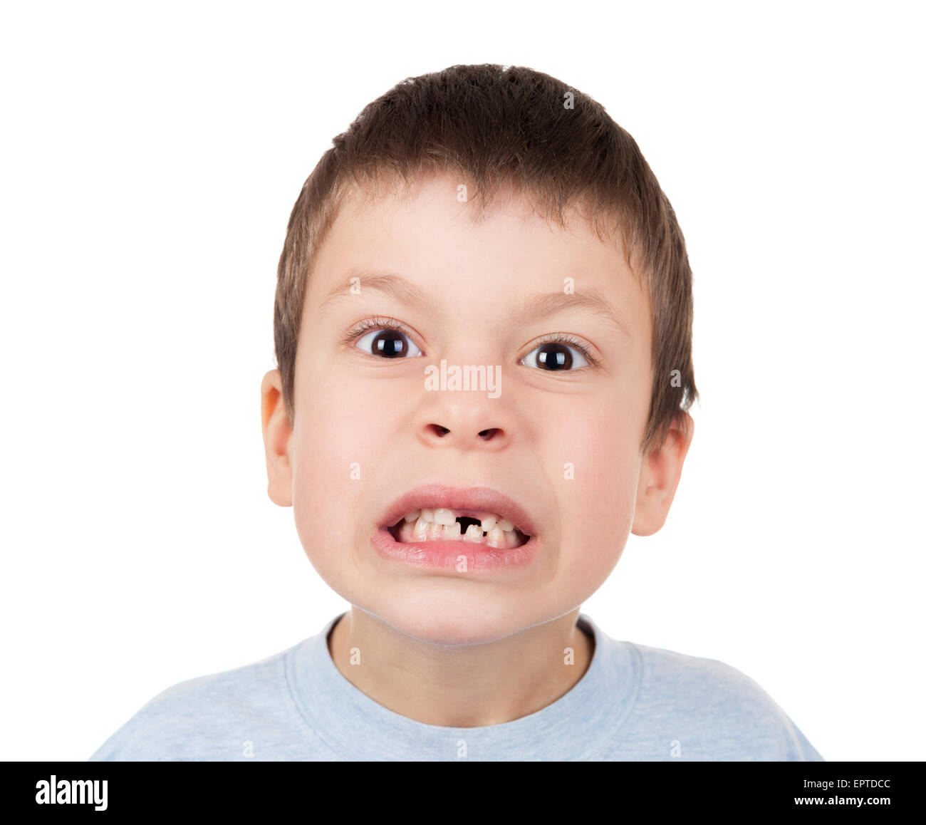 Boy portrait with a lost tooth Stock Photo - Alamy