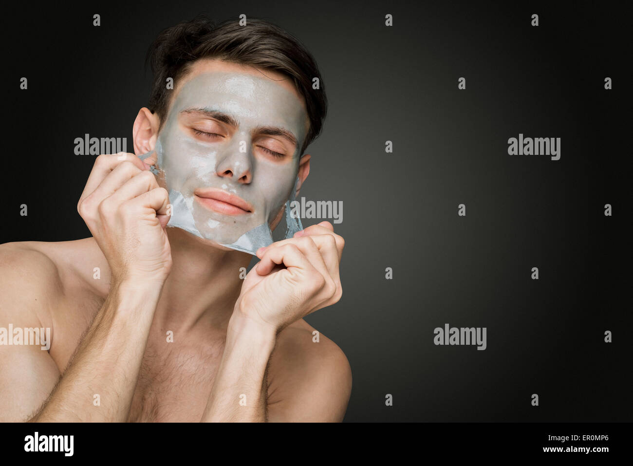 Skin peeling off hands hi-res stock photography and images - Alamy