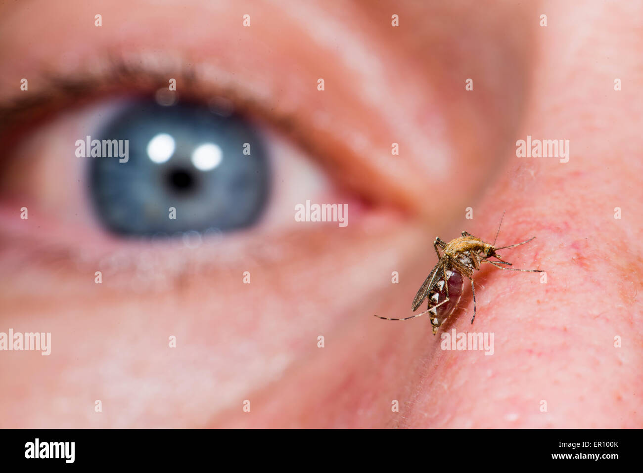 Mosquito Bites On Eye