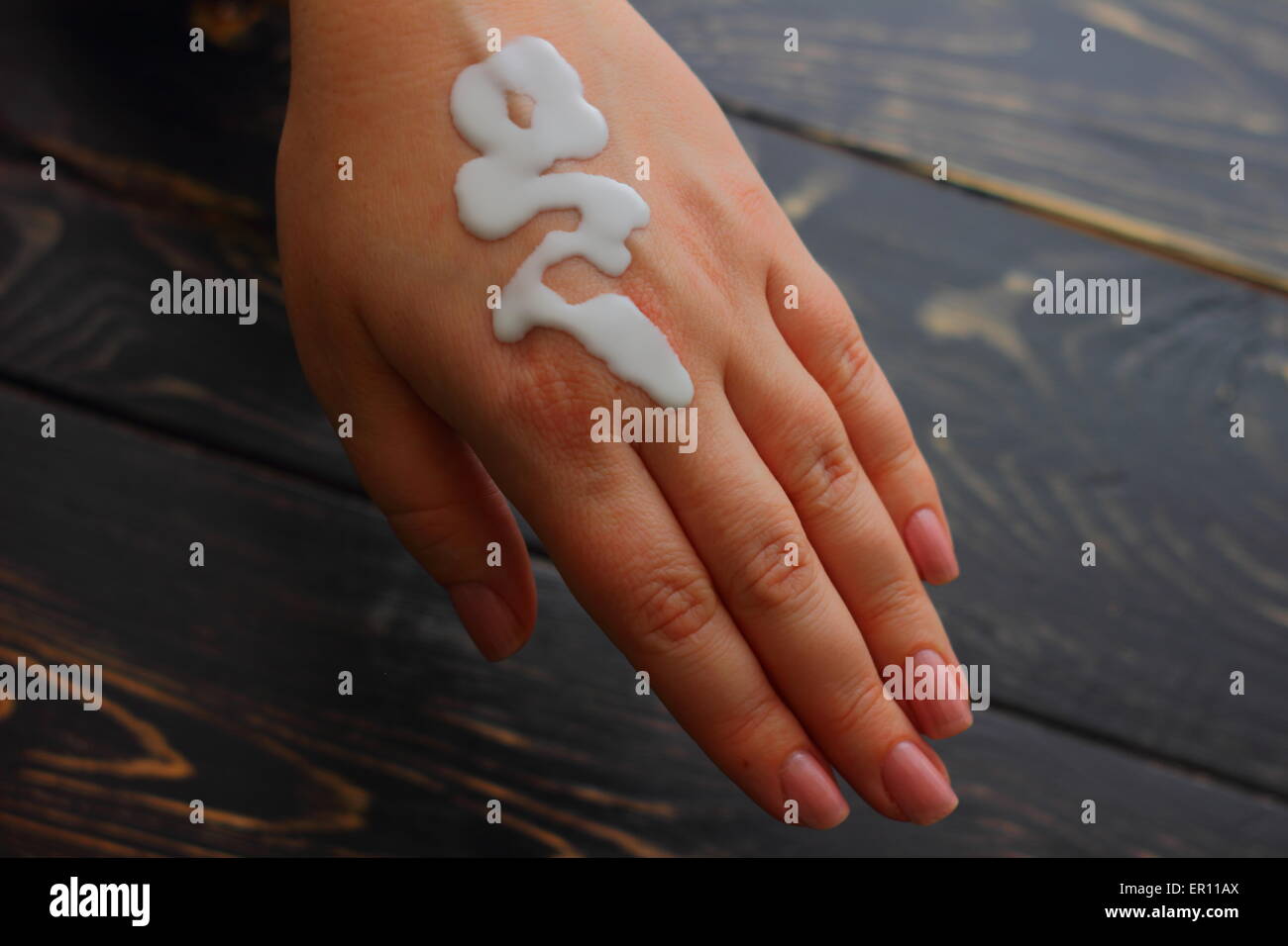 White person with skin color hi-res stock photography and images - Alamy