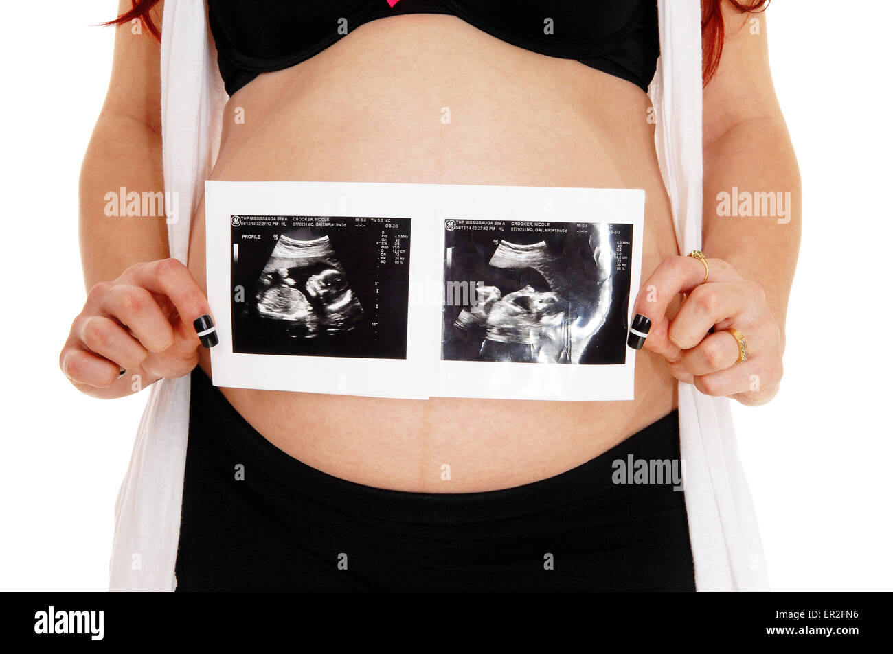 A closeup picture of the belly of a pregnant woman holding the ...