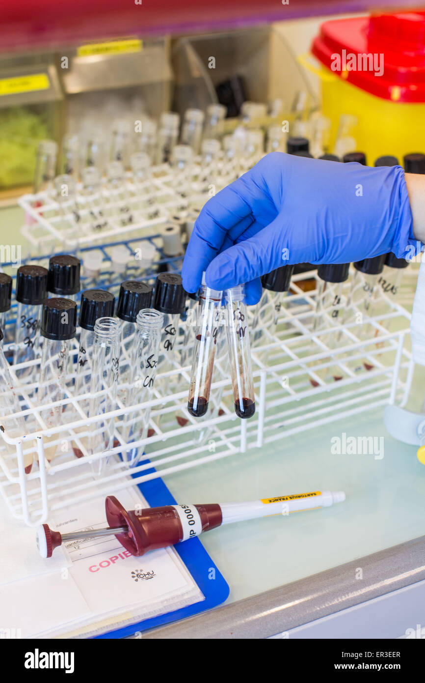 Cyanide determination in blood. Forensic analysis, Laboratory of ...