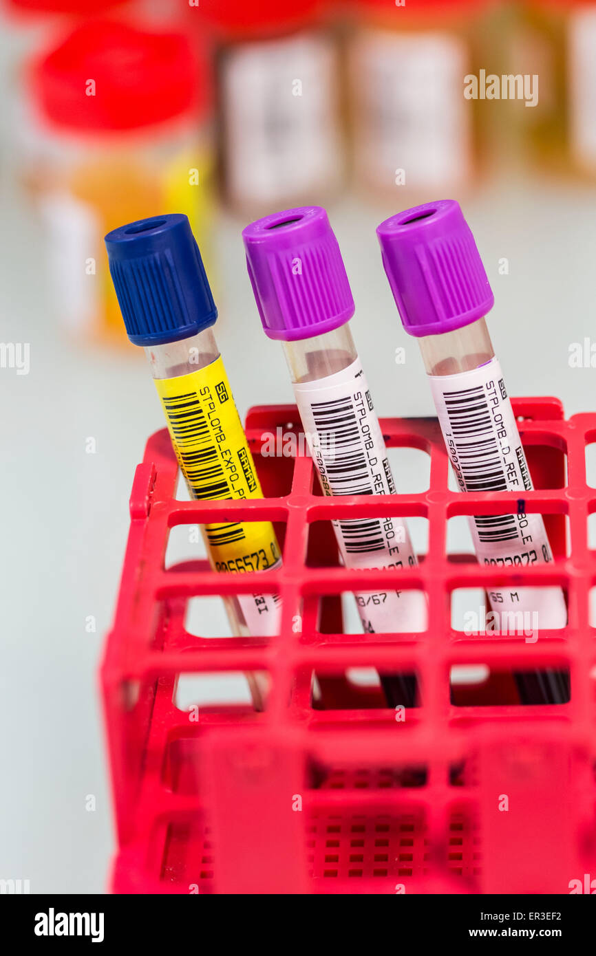 Blood poisoning hi-res stock photography and images - Alamy